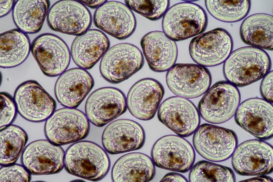 Muscle under a microscope. : Damnthatsinteresting